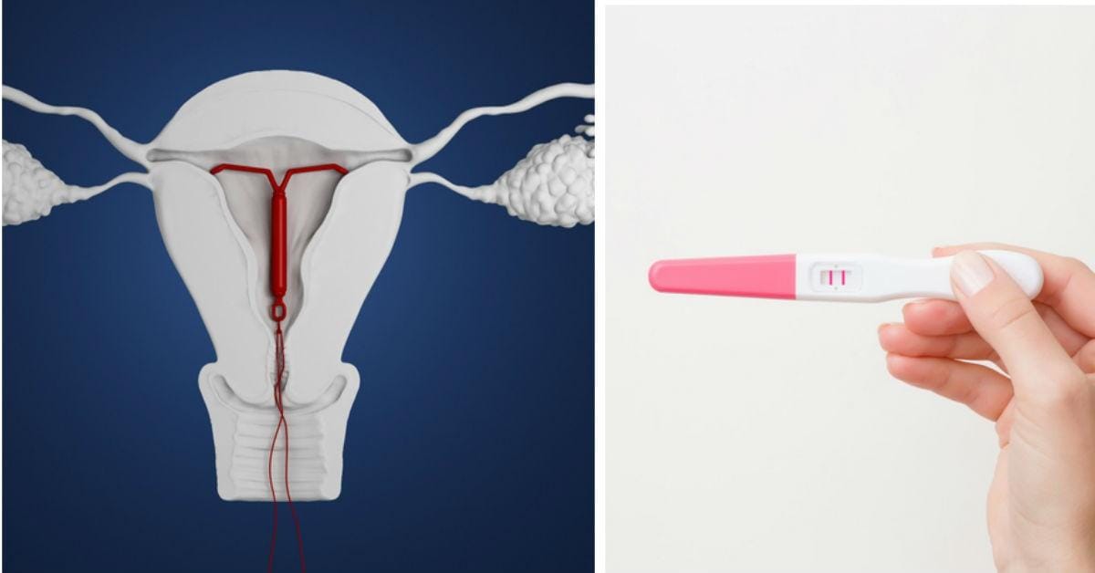 ¿Qué sucede si te quedas embarazada con el DIU? - Embarazo y Bebes